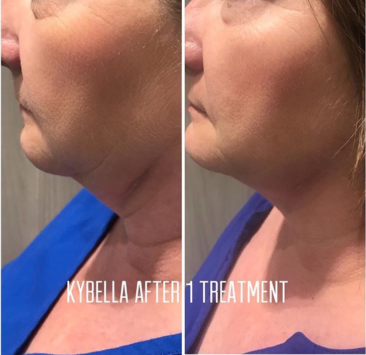 Gilbert Salon & Spa Services | Colair Beauty Lounge & Med Spa Gallery